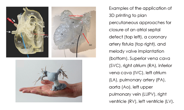 Topic: Three-Dimensional Printing Applications in Percutaneous ...