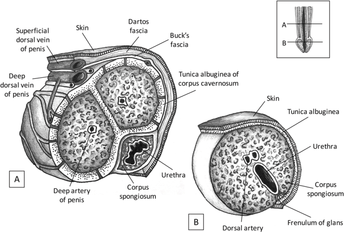 Szikra Matematikus Ugr deszka Tarred Skin On Penis P rg s Jabeth Wilson Nagylelk 