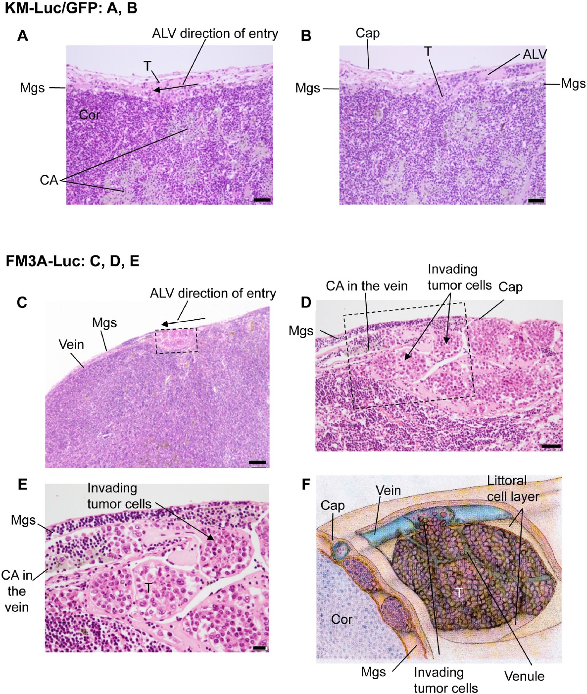 Intrapulmonary Lymph Node A Marginal Sinus Lymphoid Frontiers | The