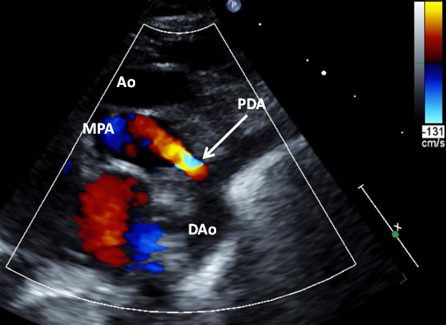 Echocardiography: an overview - Part III