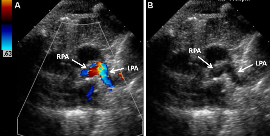 Echocardiography: an overview - Part III