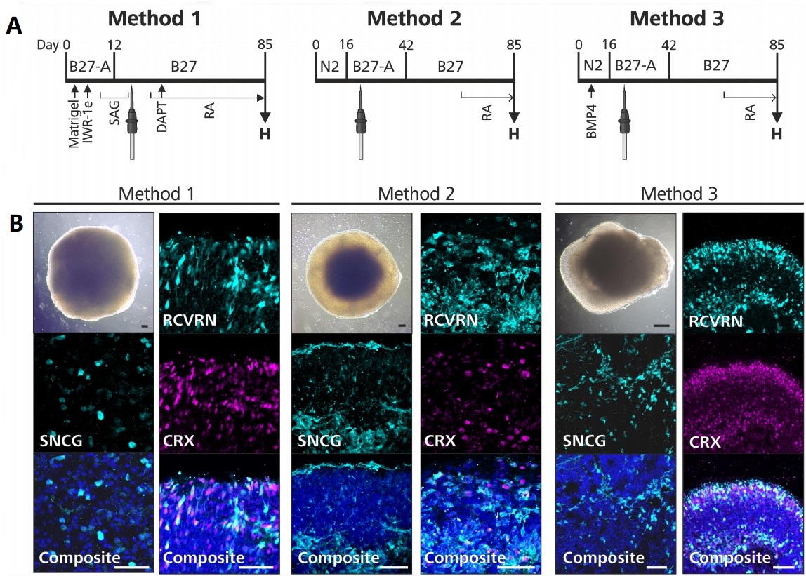 Retinal organoid differentiation methods determine organoid cellular ...