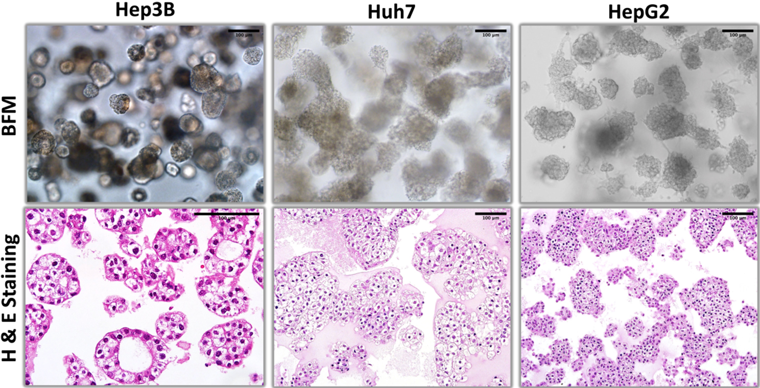 3D Organoid modelling of hepatoblast-like and mesenchymal-like ...