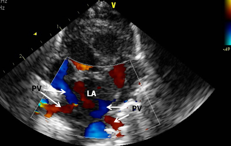 Echocardiography: an overview - part I