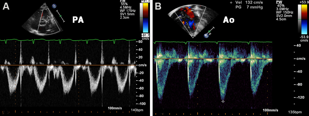 Echocardiography: an overview - part I