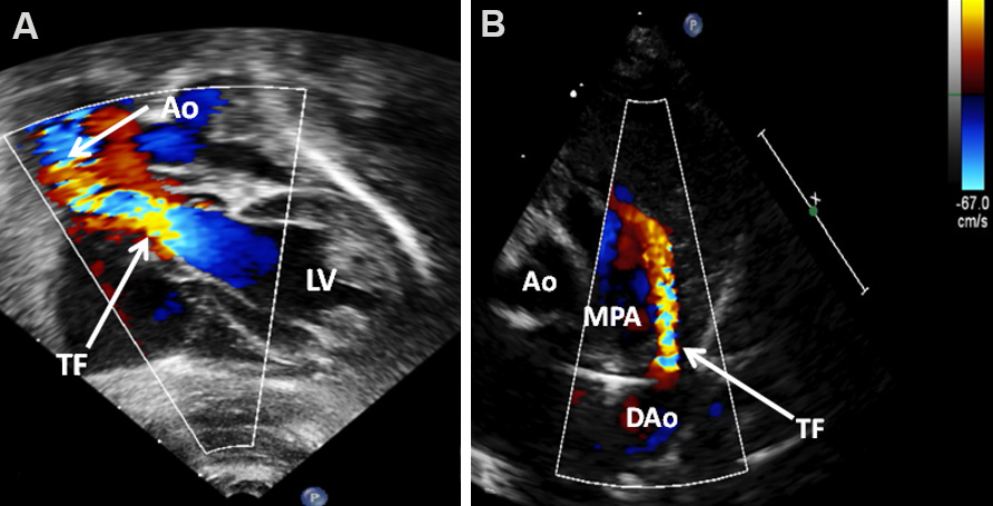 Echocardiography: an overview - part I